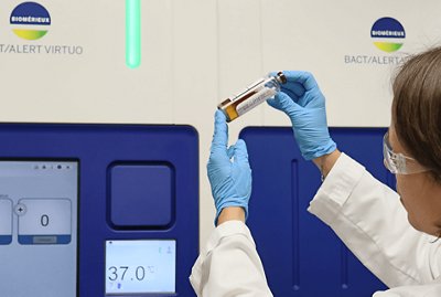 VIDAS® KUBE™ Automated Food Pathogens Detection | Pioneering Diagnostics